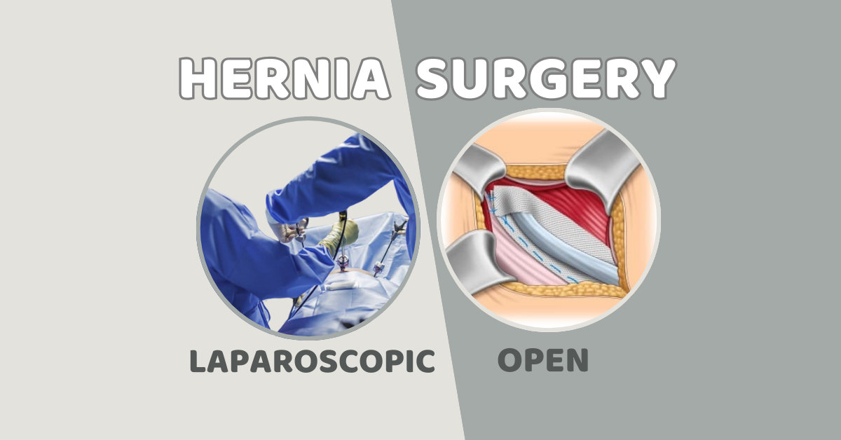 Inguinal Hernia Repair
